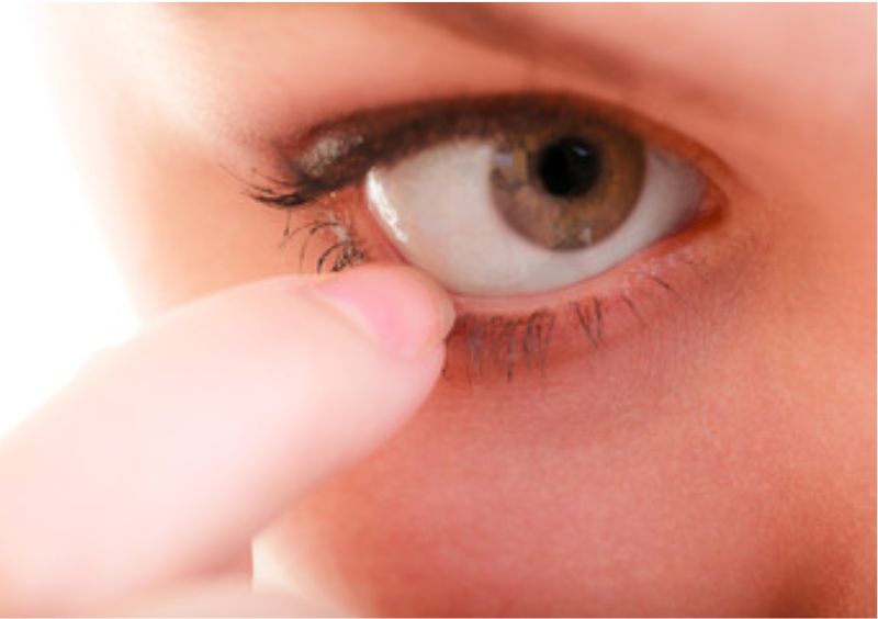 Meibomian Gland Dysfunction | MGD Causes, Symptoms & Relief